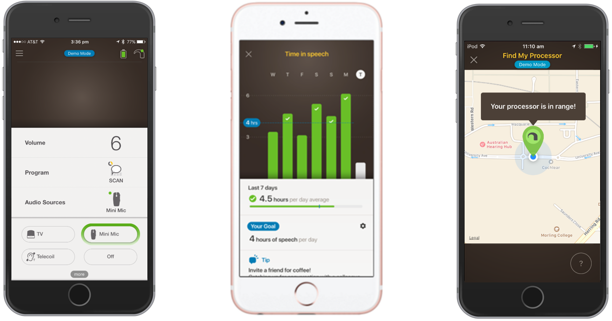 Audiology Online: Nucleus® 7 Expanded Features micro-courses - Cochlear ...