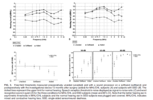 Enhance Your Hearing with Baha 6 Max Sound Processor | Cochlear ProNews
