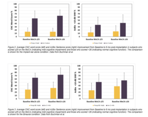 Clinical Quick Tips: Optimizing your CI fittings with the Cochlear ...