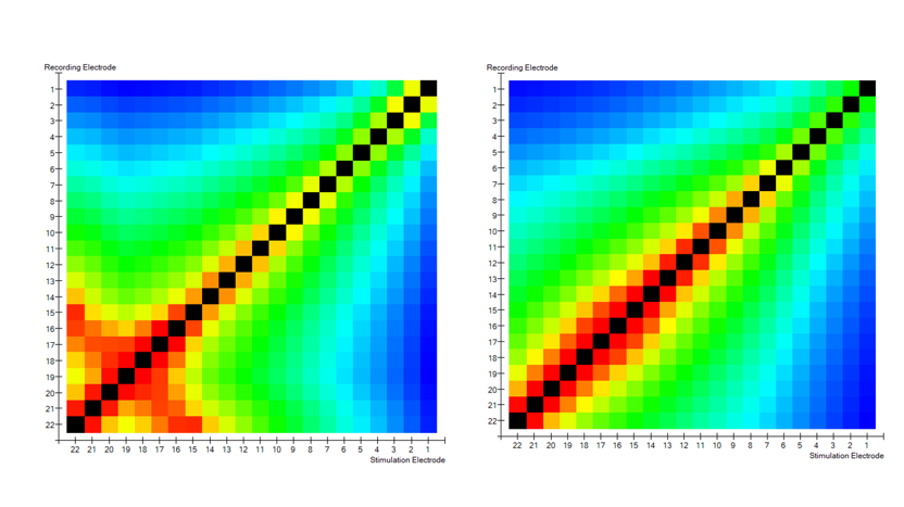 Case study: Intraoperative correction of a CI632 placement using the ...