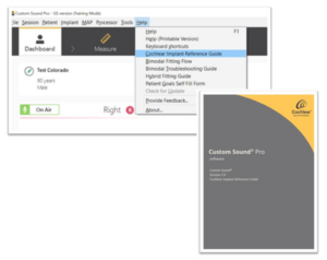 Clinical Programing Series: Pulse Width - Cochlear ProNews