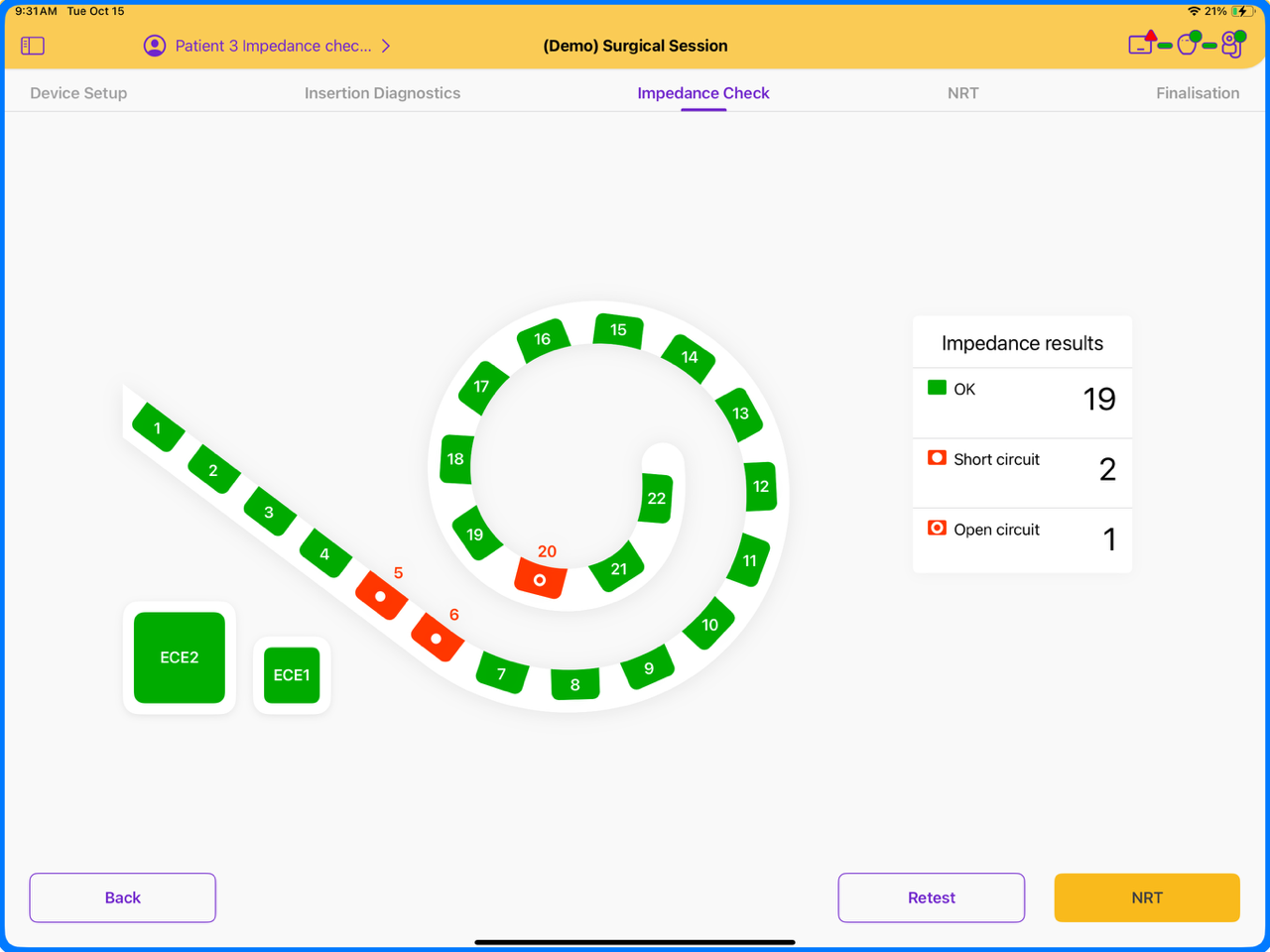 A Deeper Dive into Nucleus® SmartNav Intraoperative Testing - Cochlear ...