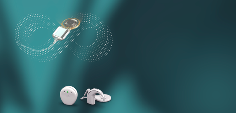 The Cochlear™ Nucleus® Nexa® System: The Next Era of Cochlear Implant ...
